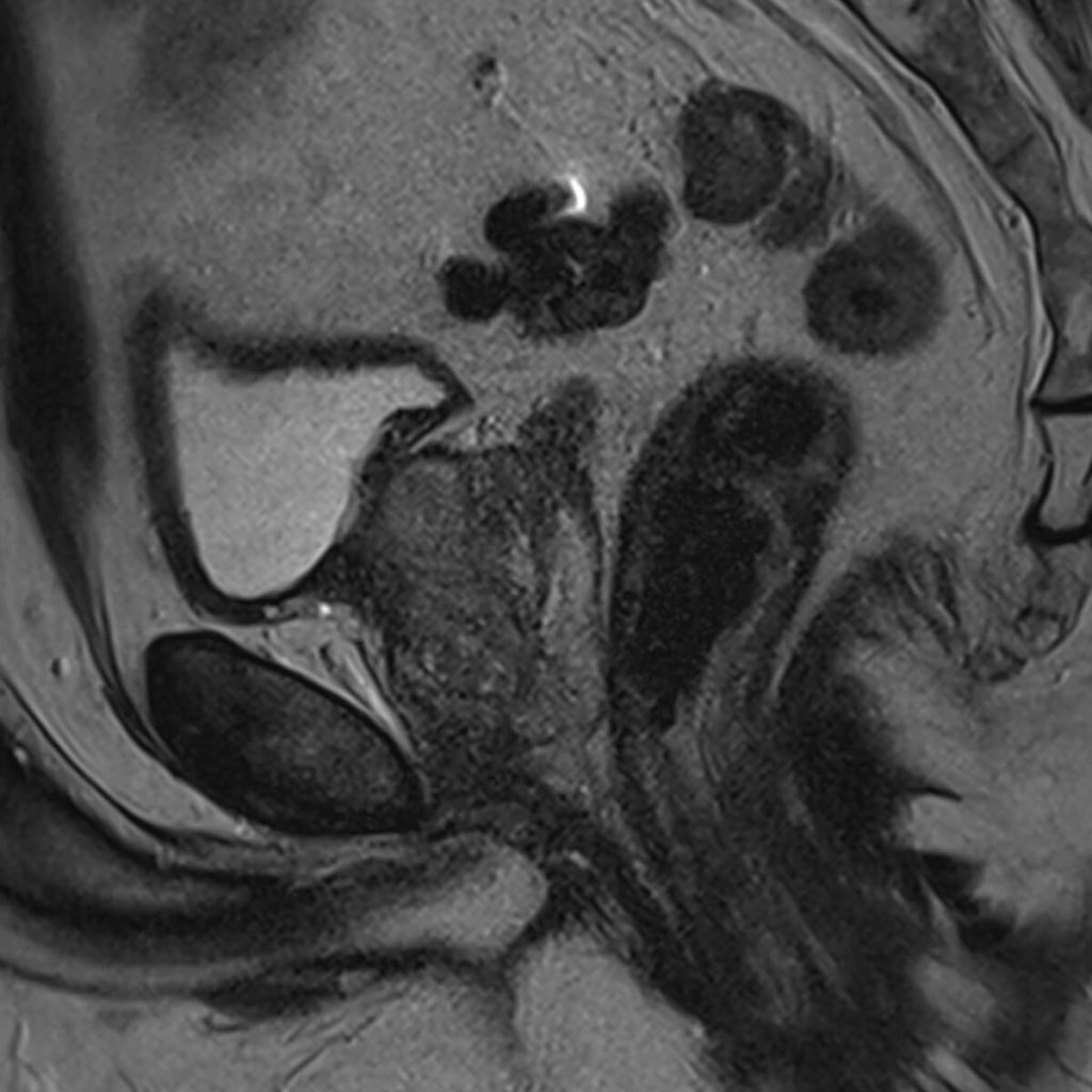 Prostata MRT Frankfurt – Dr. Behrens & Dr. Schloß